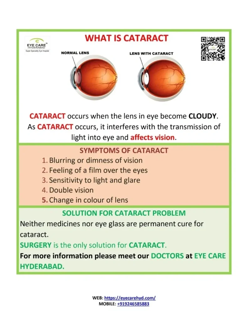 What is Cataract ? Symptoms and Problems of Cataract - Eyecare